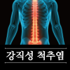 강직성 척추염 검사 증상 원인 진단 치료 완치 가능할까 네이버 블로그